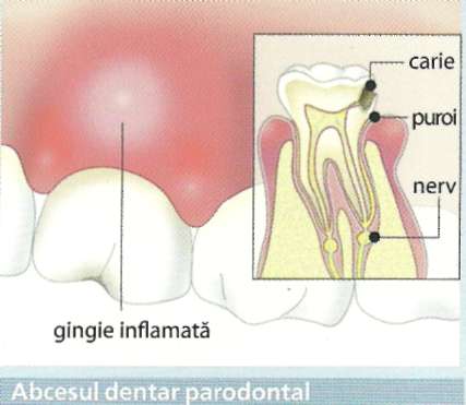 Imagini Dinti - Anatomia dintilor - Corpul Uman - Informatii medicale ...